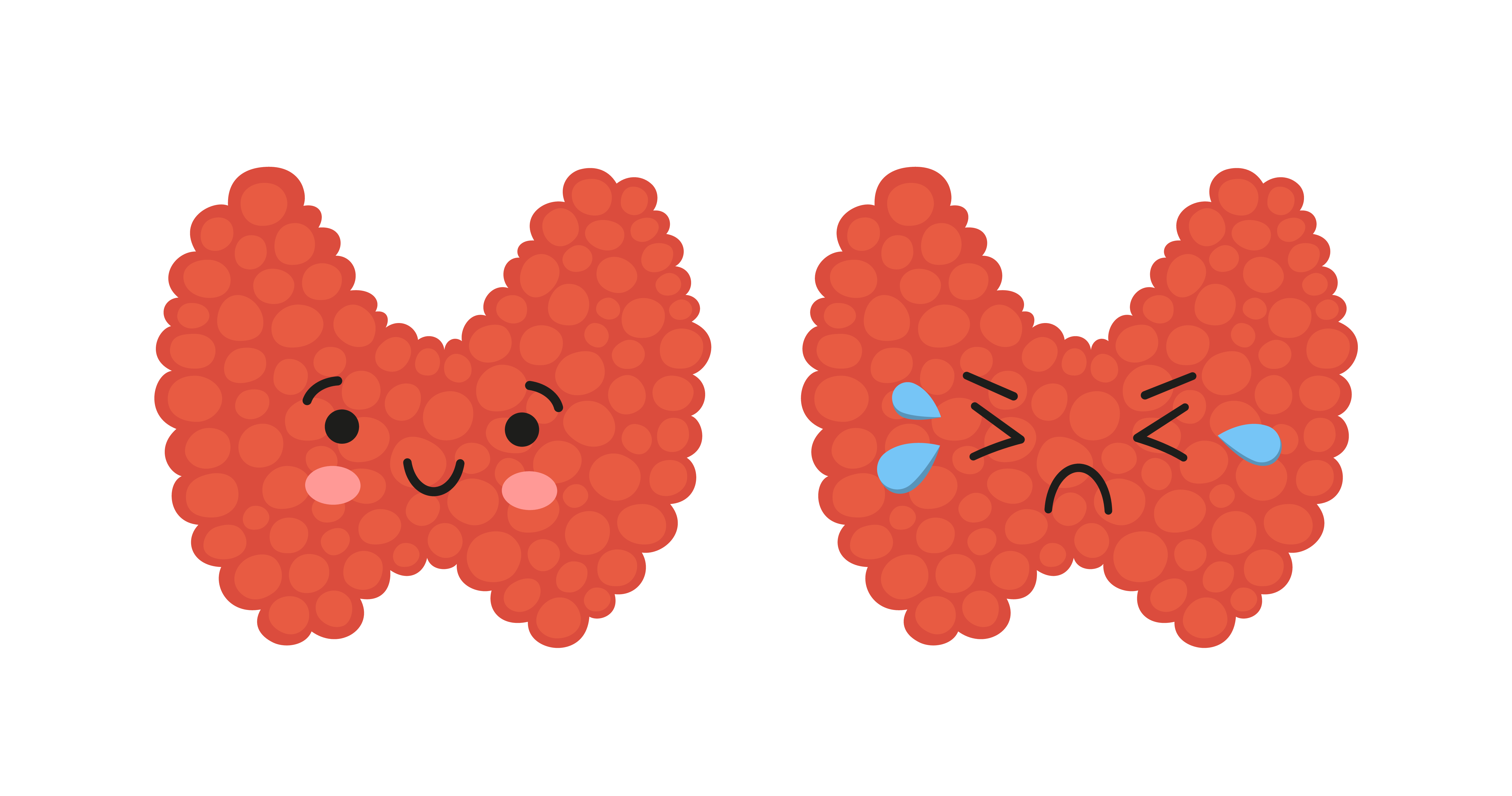 Hipoparatiroidismo postquirúrgico