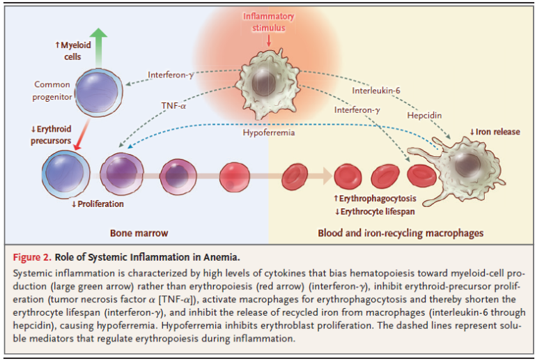 Anemia por inflamación