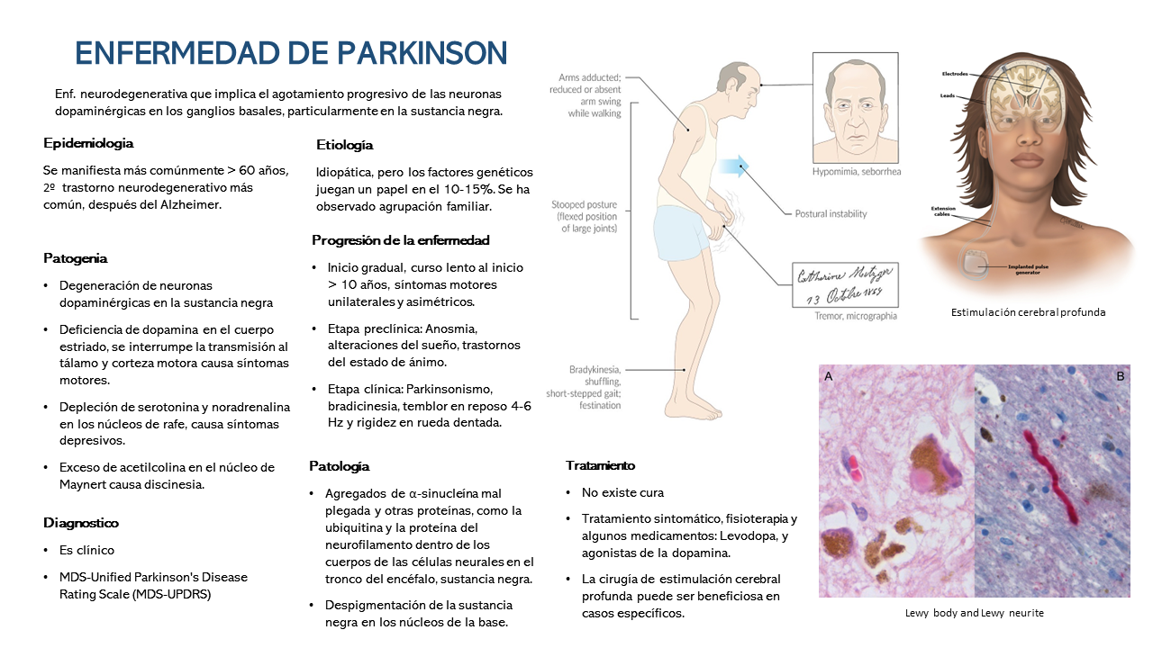 Enfermedad de Parkinson