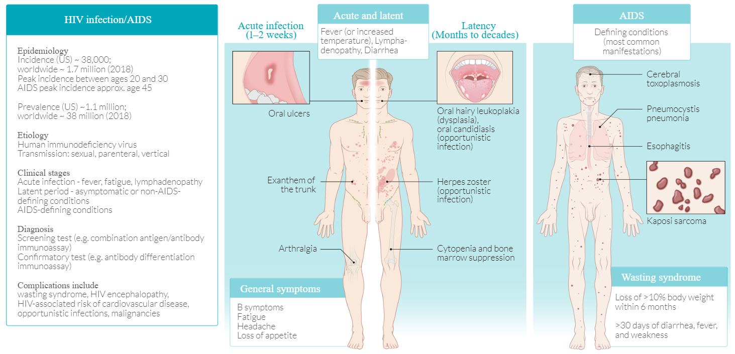 Infección aguda por VIH
